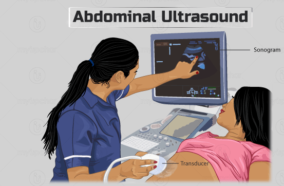 Sonography - Sankhala Hospital